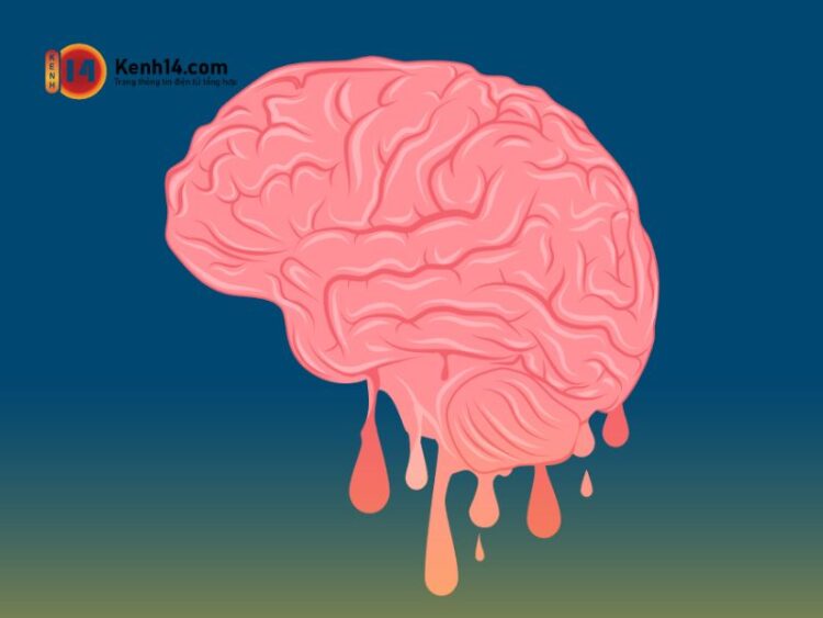 Brain rot là gì? Hiểu đúng về hiện tượng “thối não” gây báo động